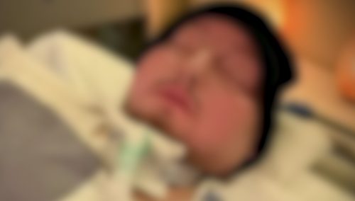 Morre “príncipe adormecido” após 20 anos em coma