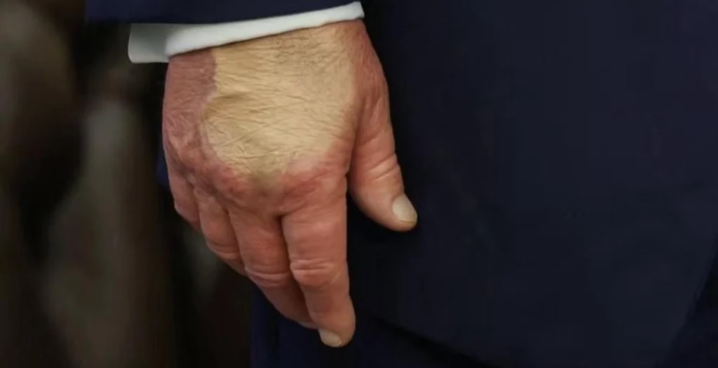 Trump usando maquiagem na mão? Entenda